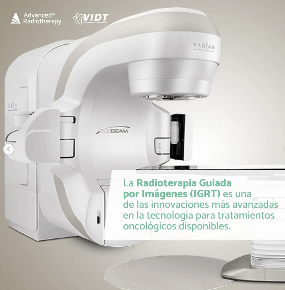 Radioterapia Guiada por Imágenes IGRT en Advanced Radiotherapy ...
