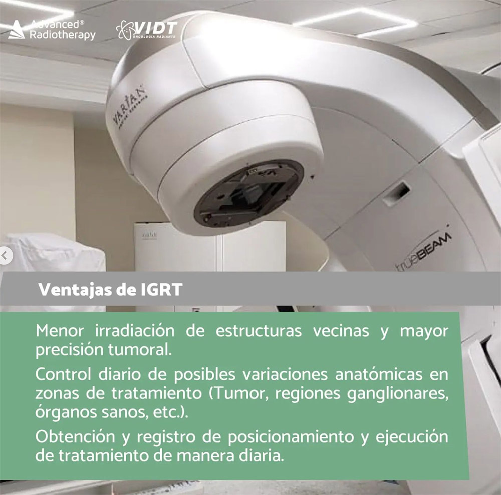 Radioterapia Guiada por Imágenes IGRT en Advanced Radiotherapy ...